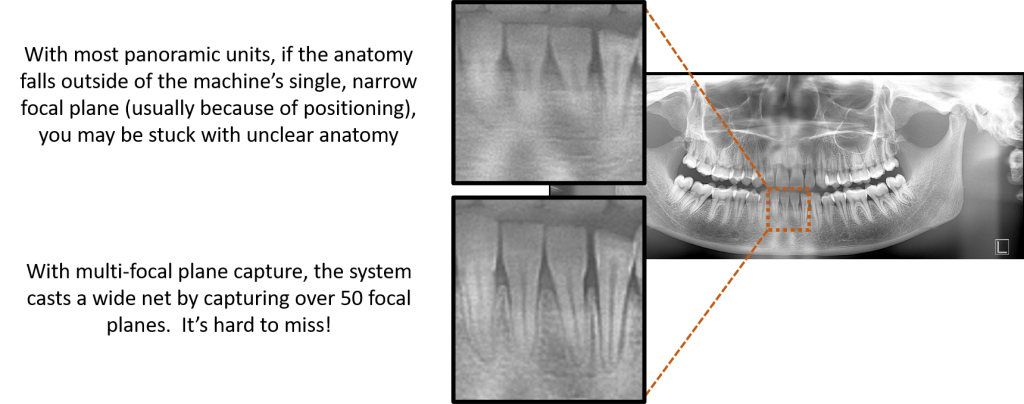 Panoura 18S – The Best Dental Panoramic X-Ray Machine for Your Money