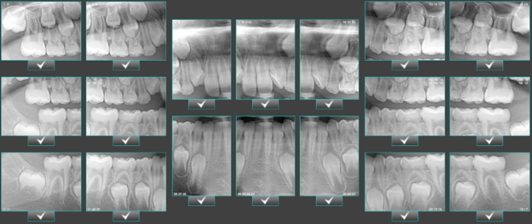 Panoura 18S – The Best Dental Panoramic X-Ray Machine for Your Money