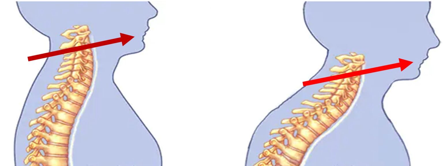 The Eight Most Common Reasons that Your Dental Panoramic X-Ray Image ...